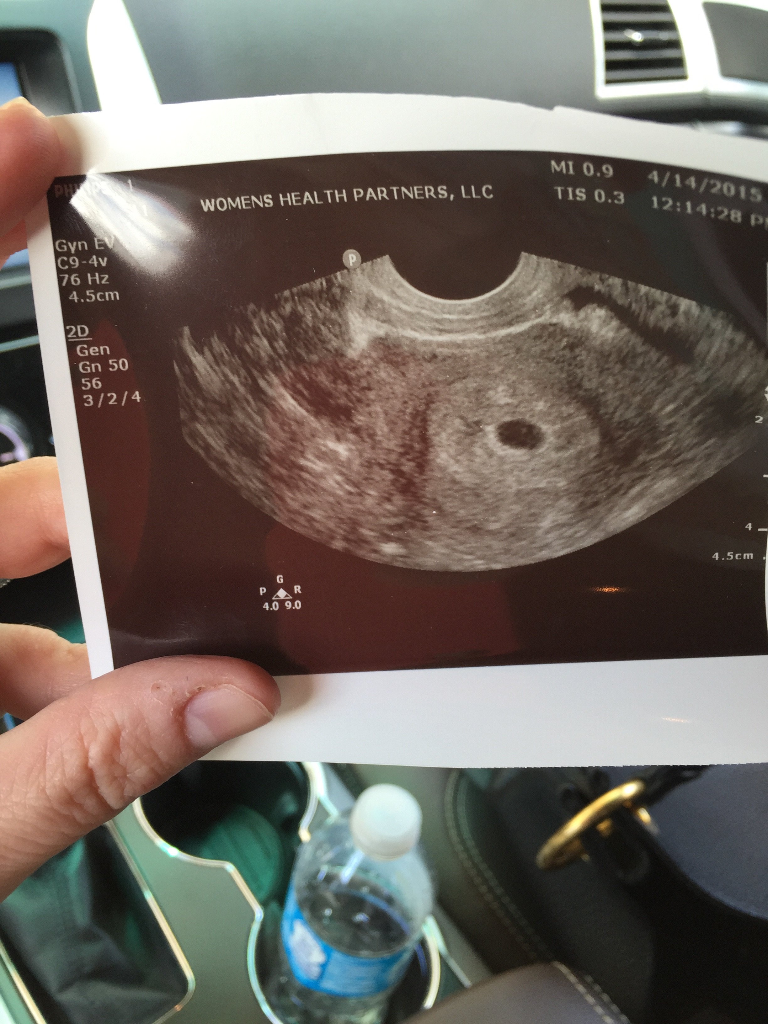 4/5 week ultrasounds — The Bump