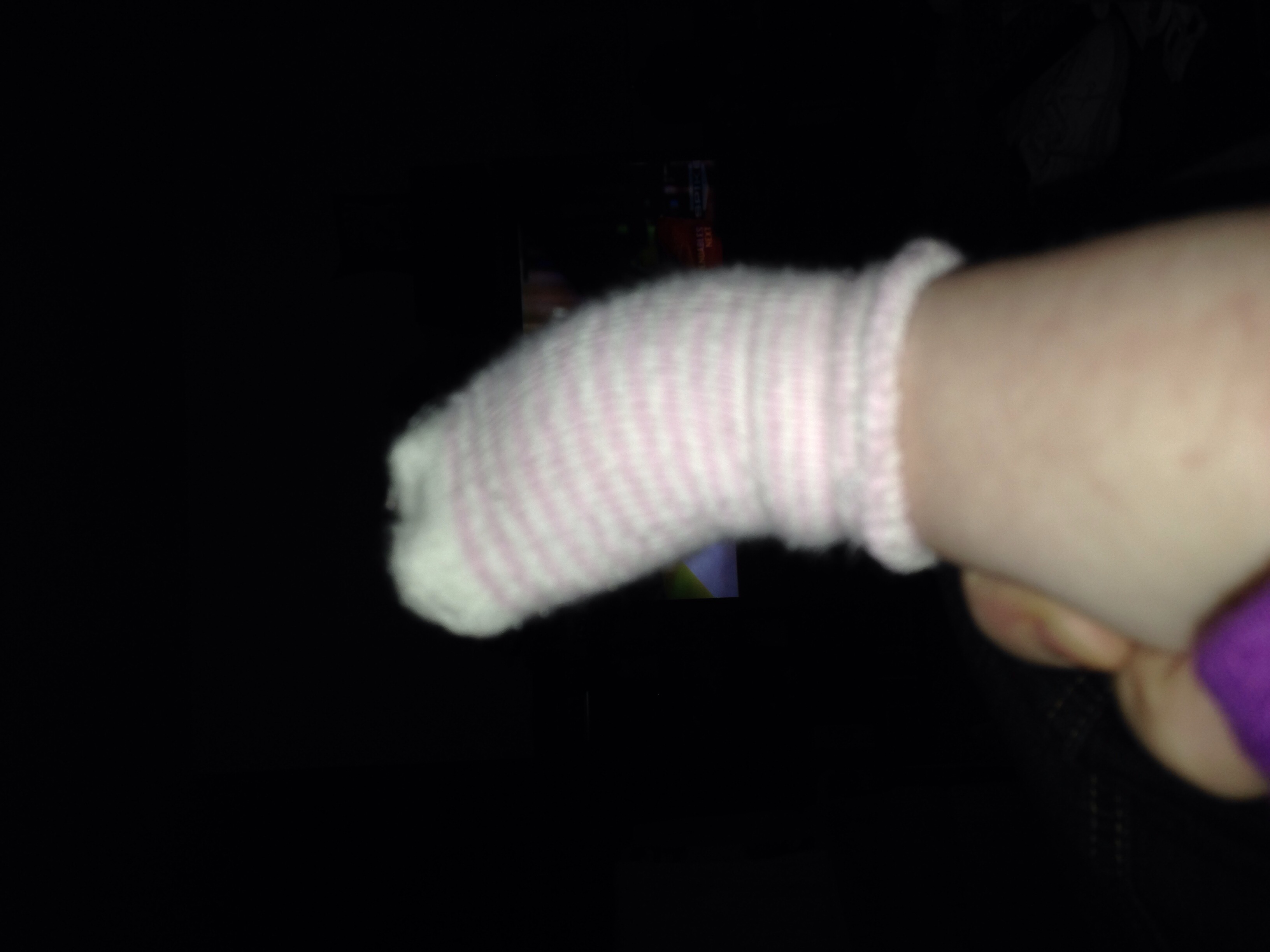 Hooked Foot — The Bump