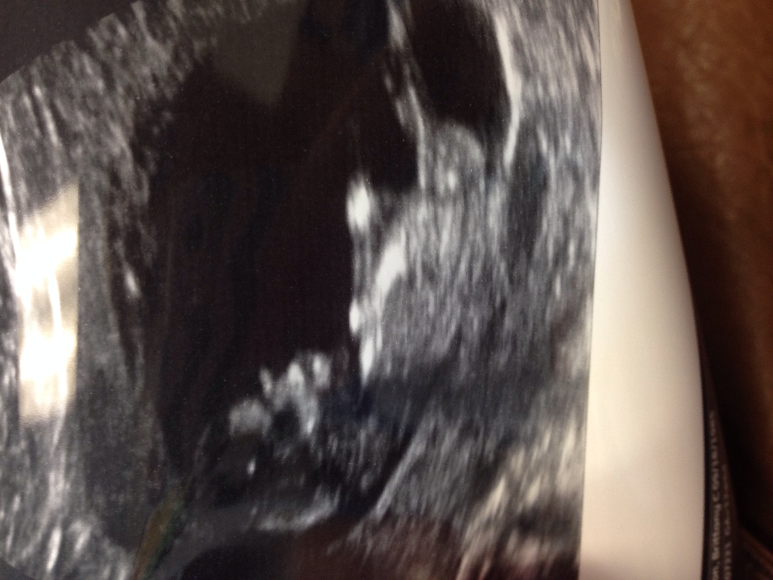 Nub picture...what is it?! — The Bump