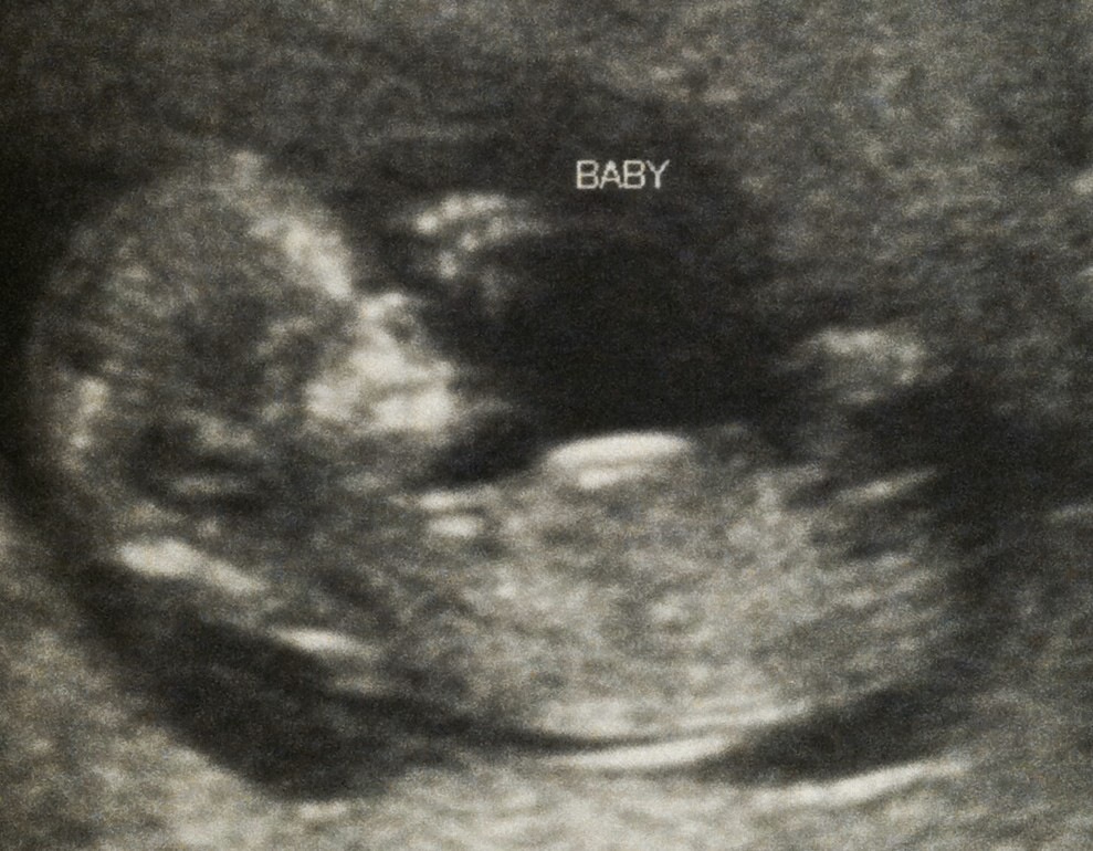 12 Week Ultrasound Pics + Nub Theory *UPDATED with the sex!* — The Bump
