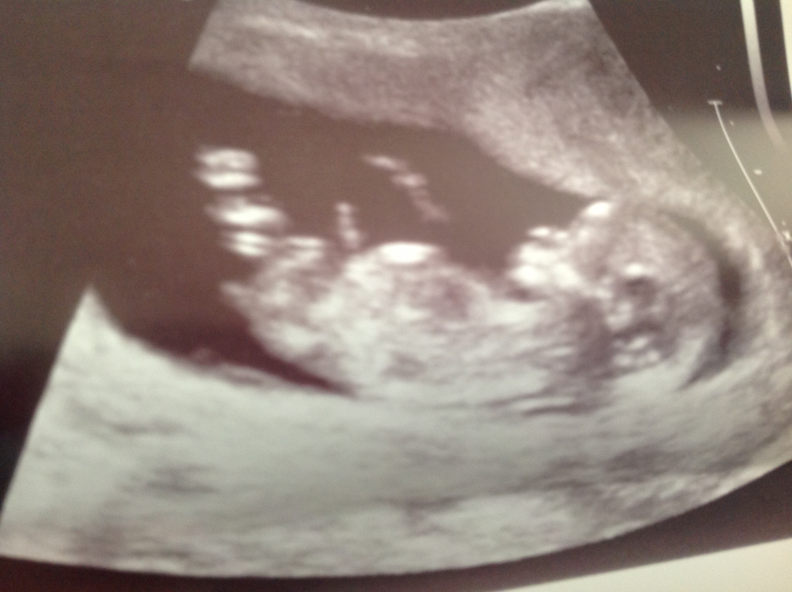 Angle of the dangle debate! — The Bump