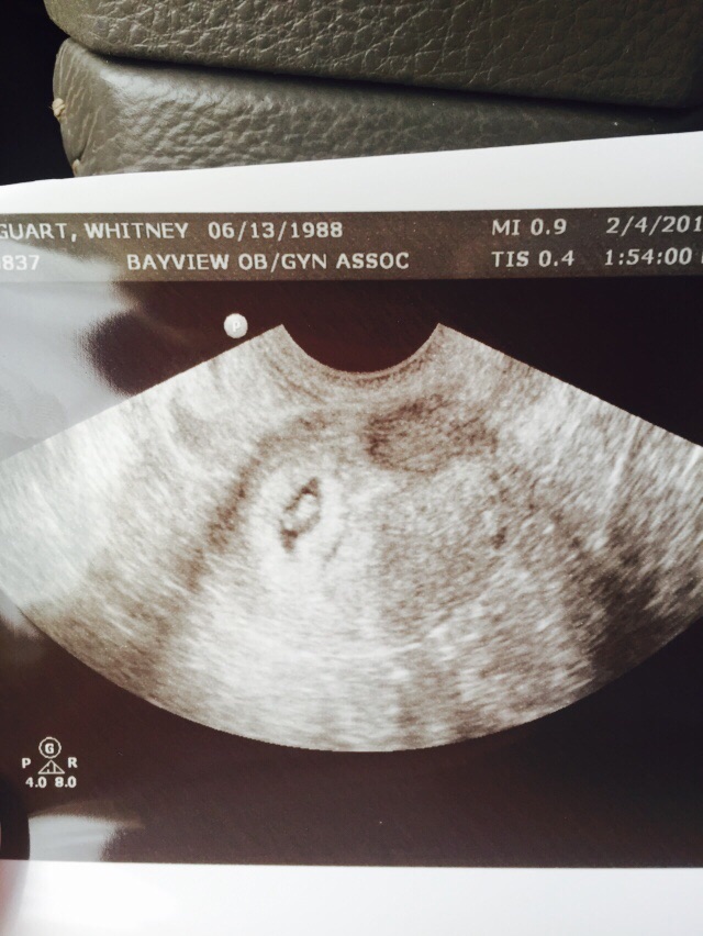 Ramzi Method — The Bump