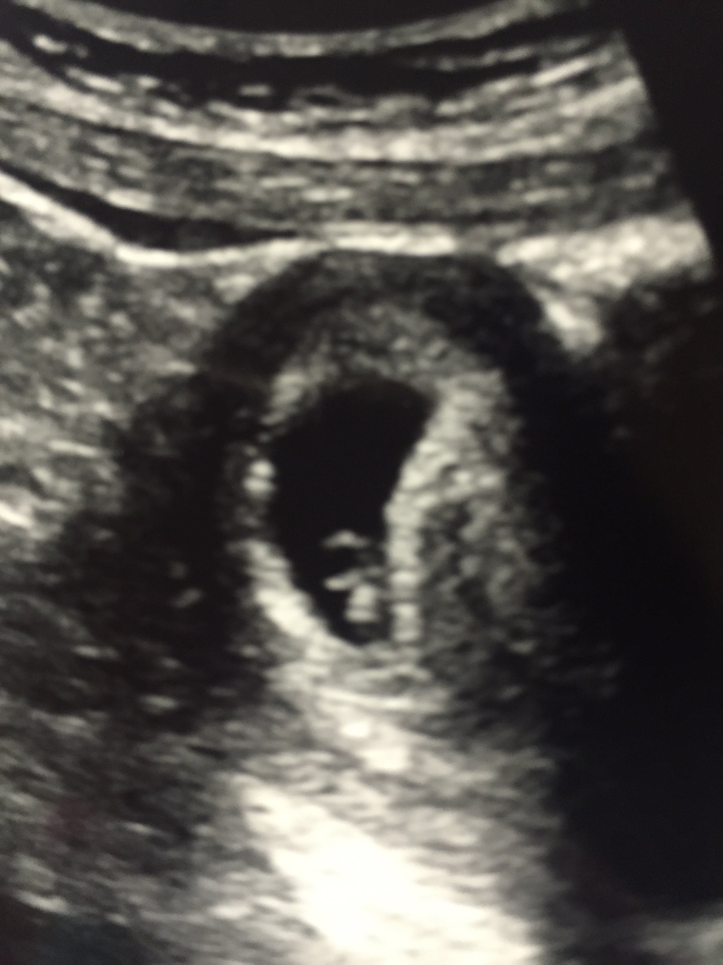 Ramzi method? — The Bump