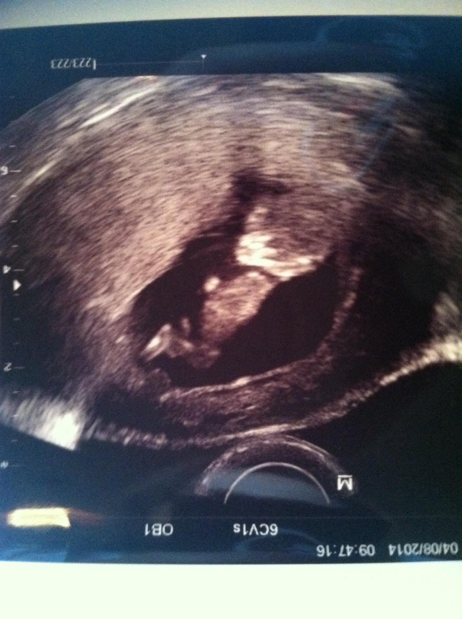 Ramzi gender prediction — The Bump