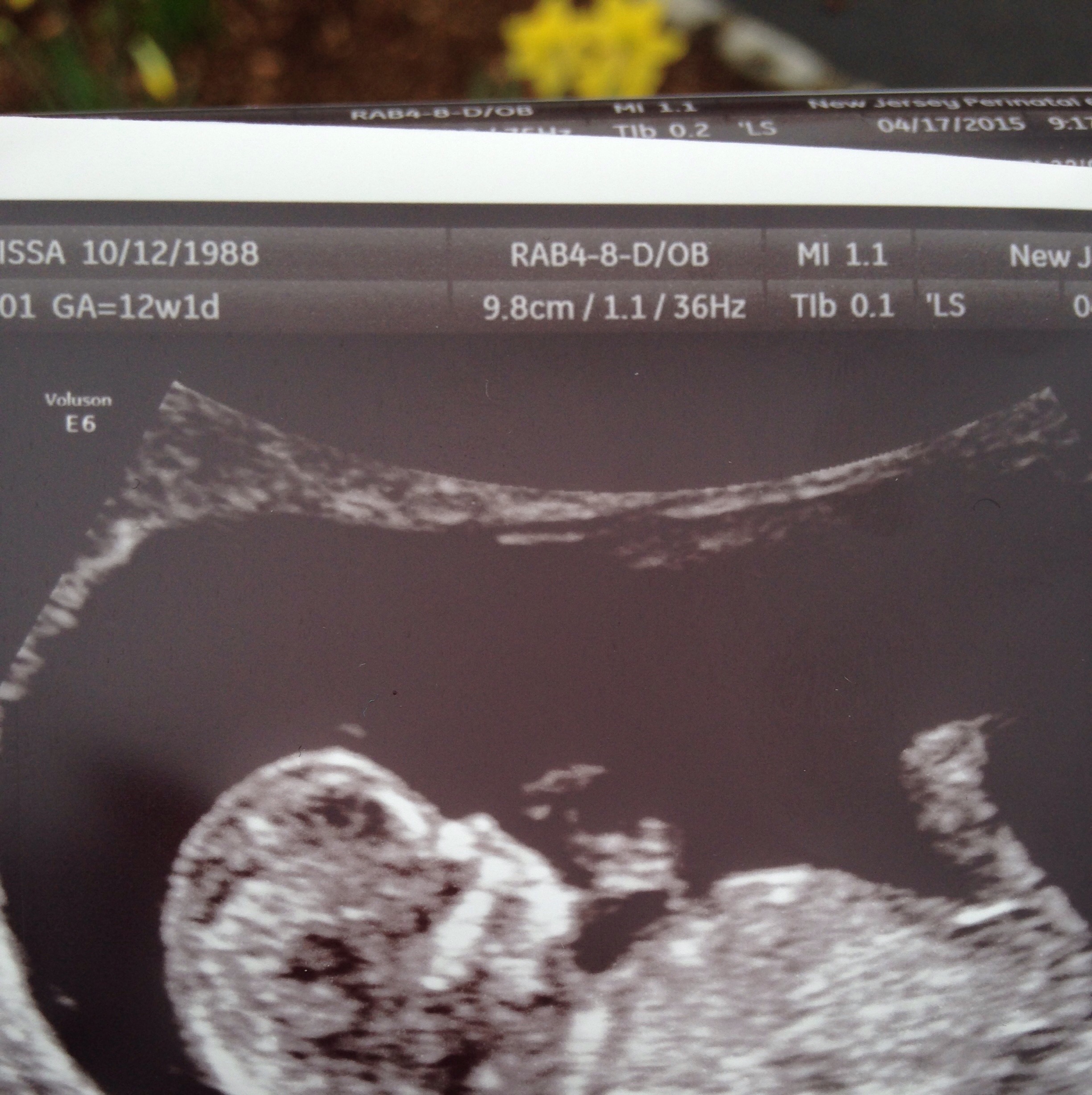 Can you see a nub? — The Bump