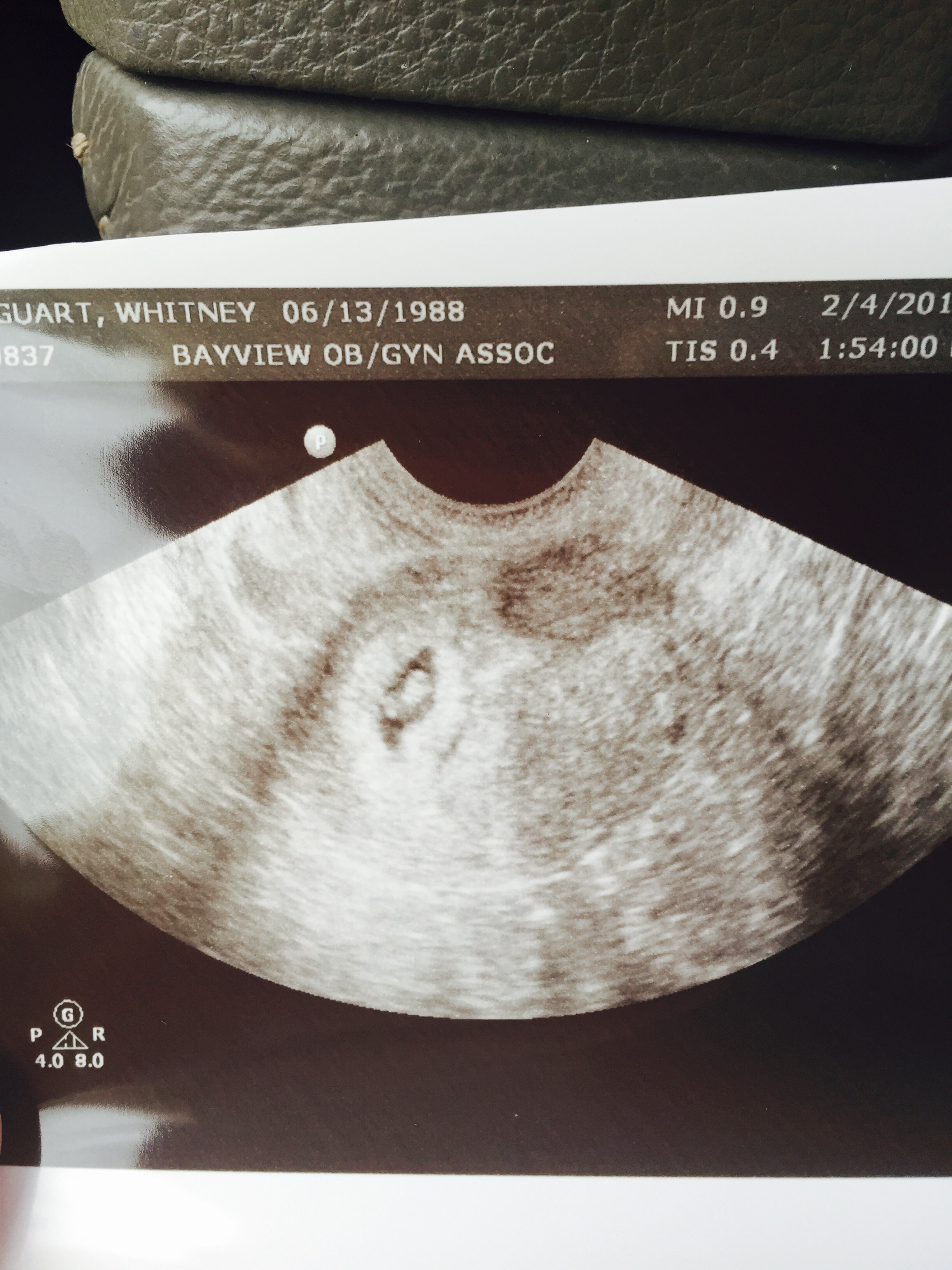 Ramzi Method — The Bump