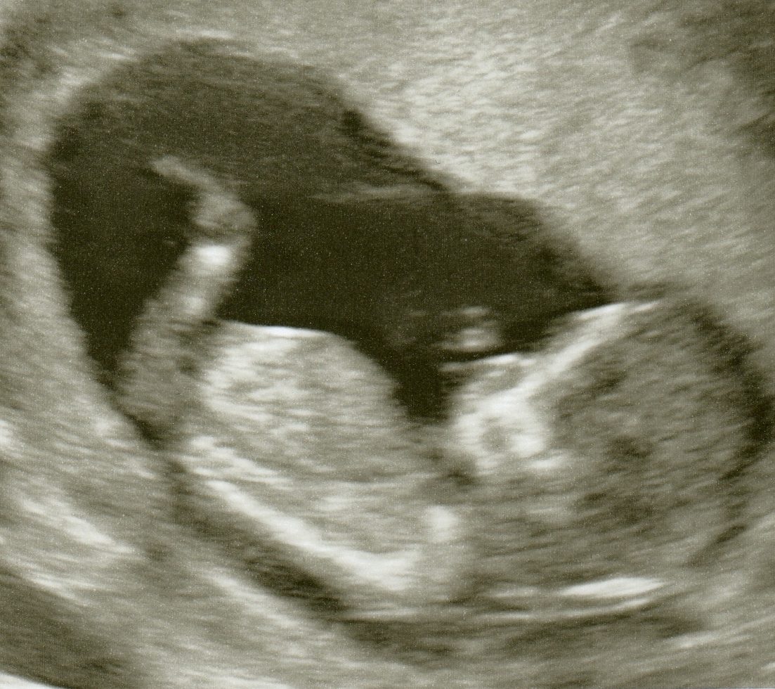 Nub theory? — The Bump