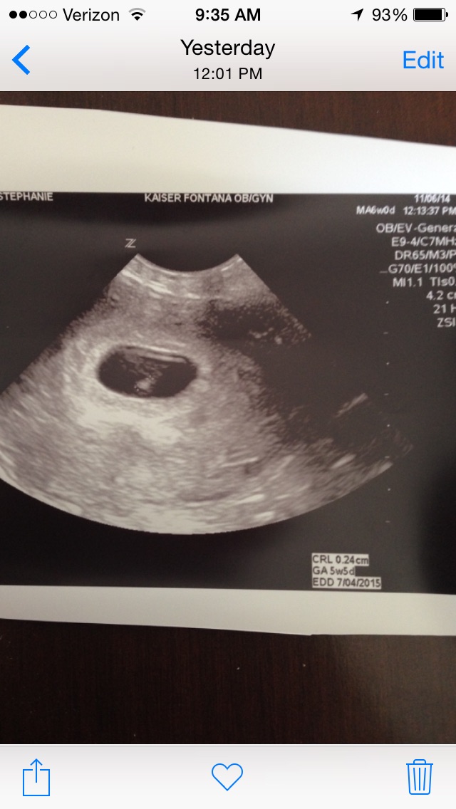 6 week ultrasound ... What did you see? — The Bump