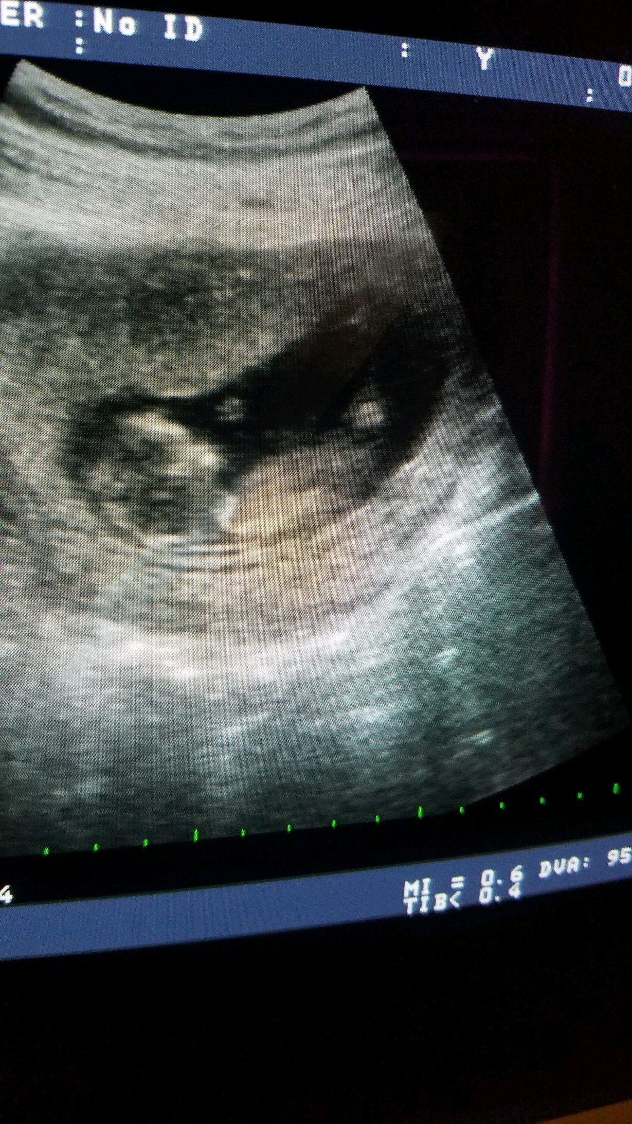 12 weeks — The Bump