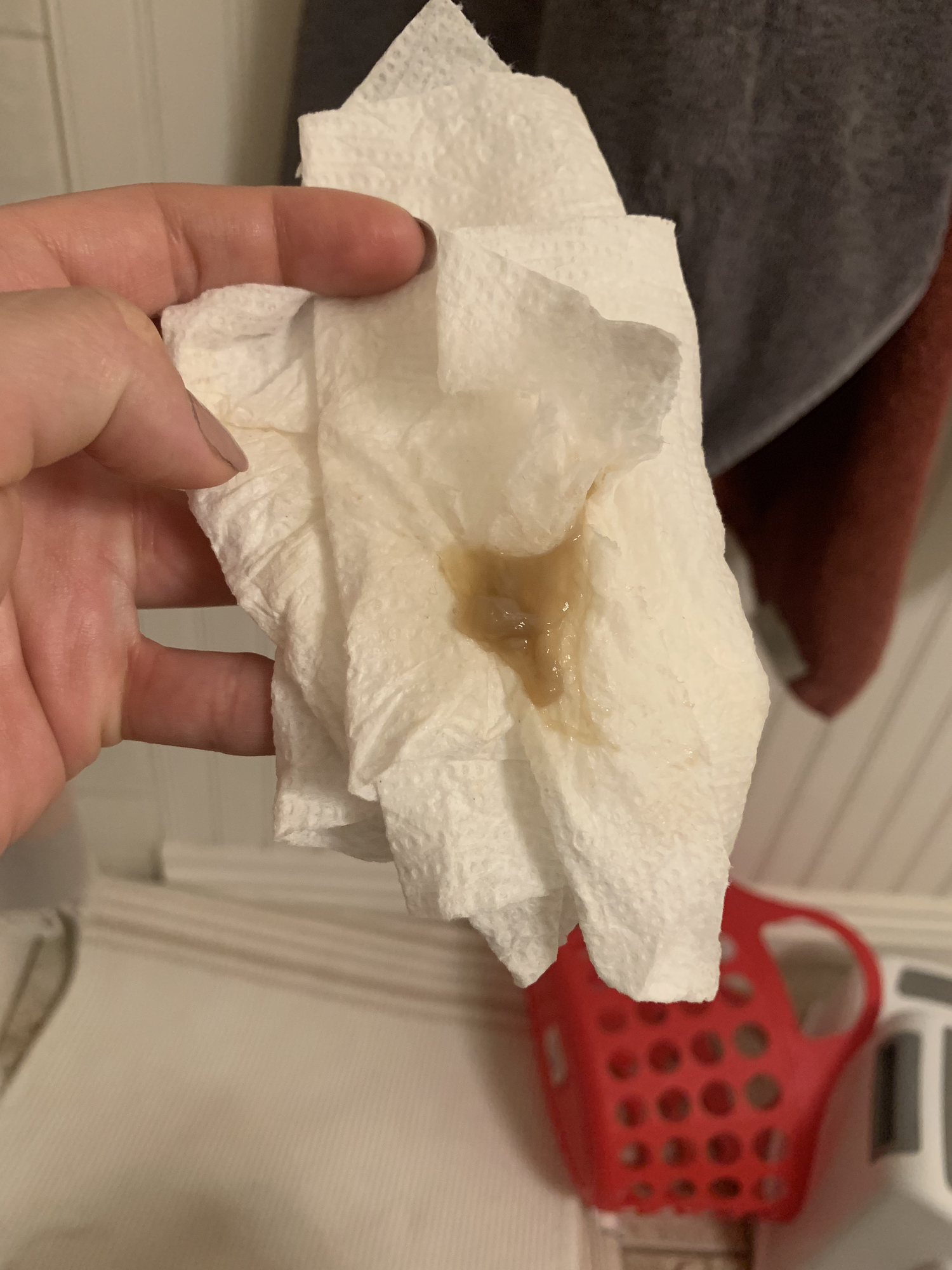 Mucus Plug Picture The Bump