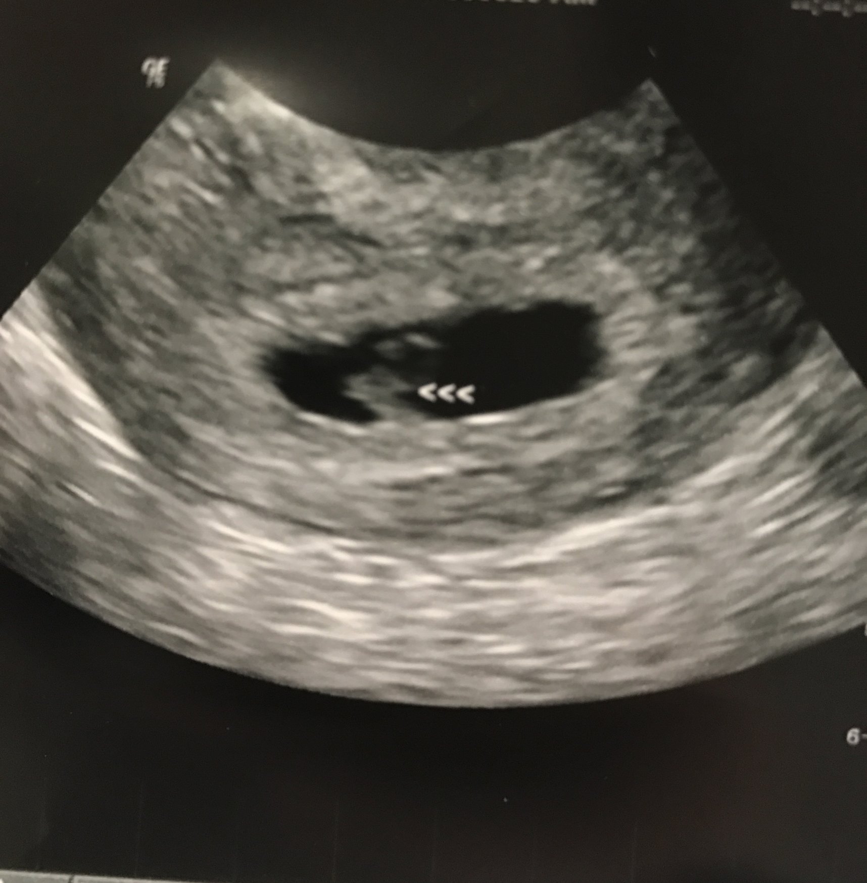 Ramzi gender prediction? — The Bump