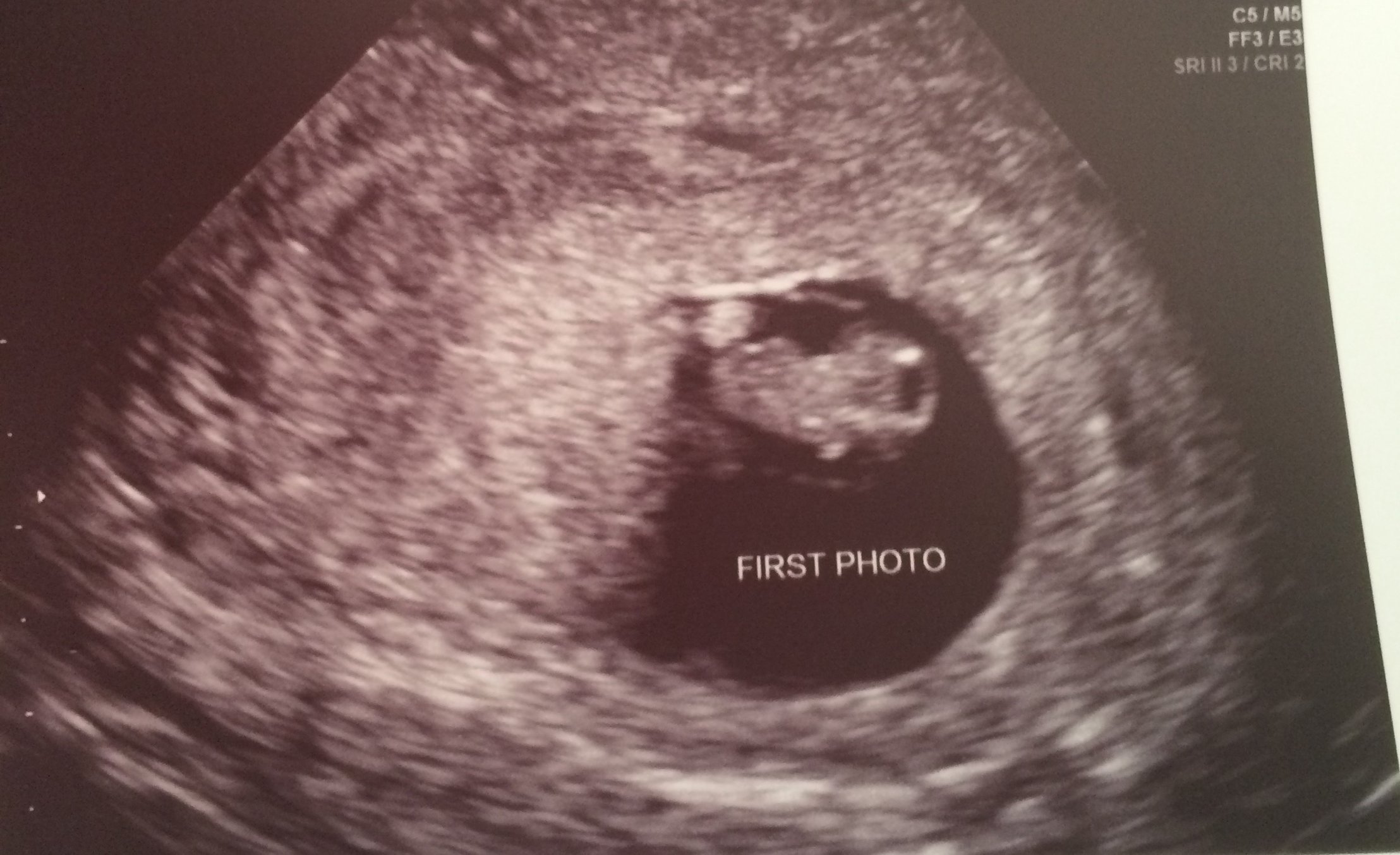 Anyone familiar with Ramzi method? — The Bump