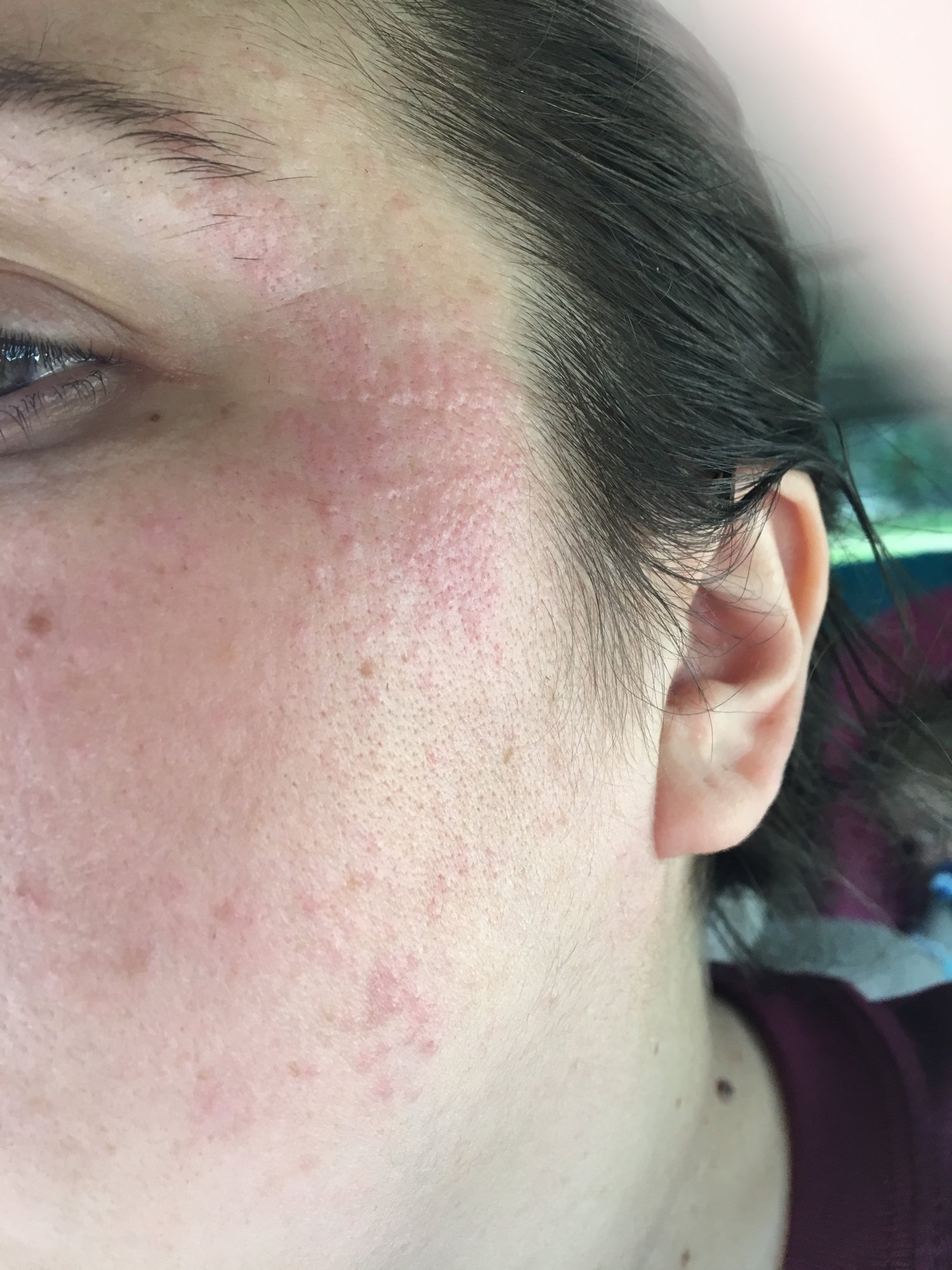 Let s Talk About Skin Care The Bump Let s Talk About Skin Care The Bump