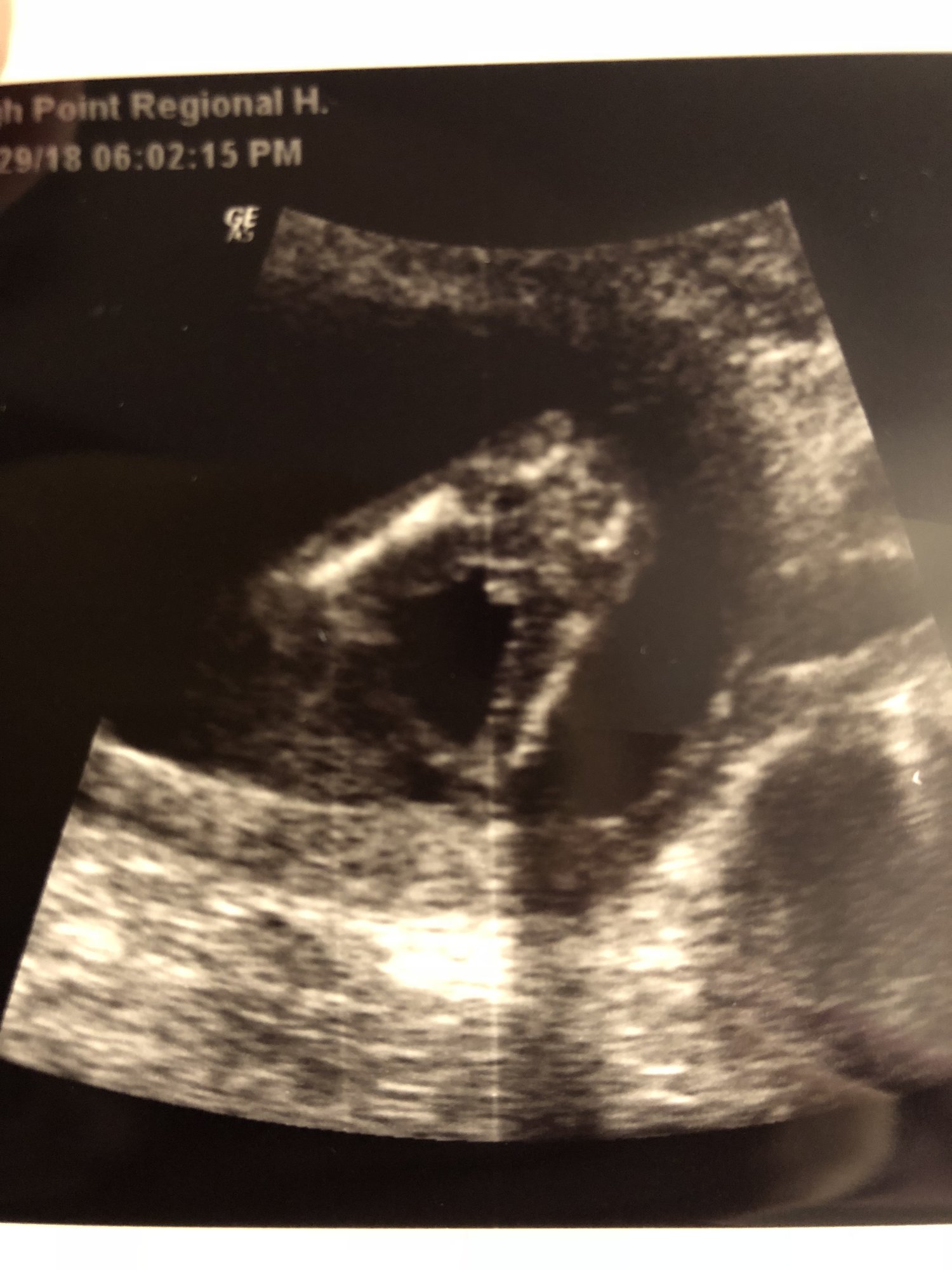 What do you think? Boy or Girl? 16 week scan — The Bump