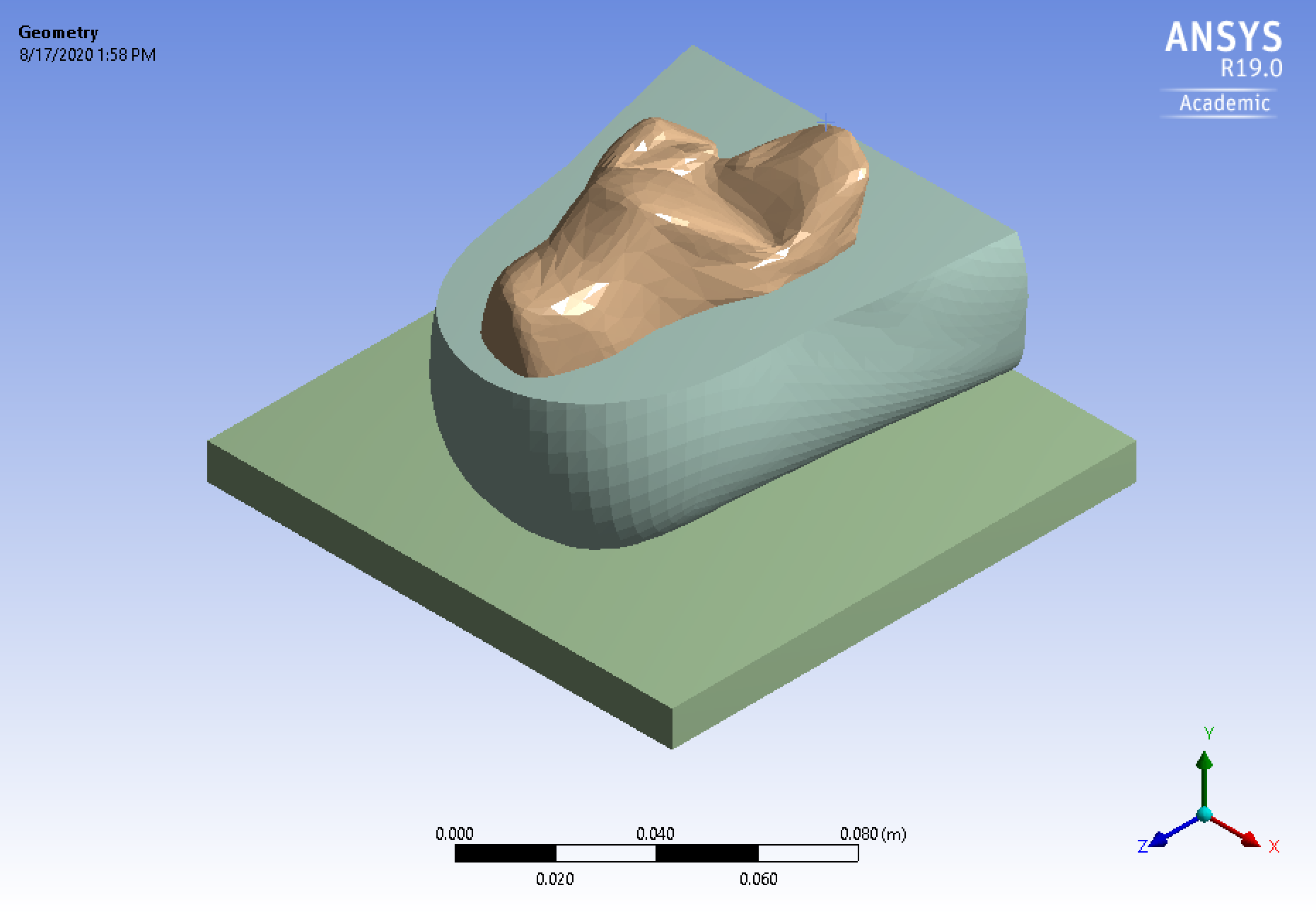 Skin Buckling in Transient Structural Analysis of Foot