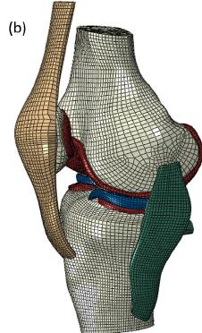 Mesh type for bones — Ansys Learning Forum